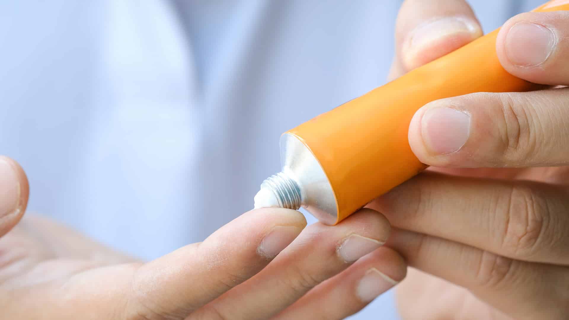 Importance clinique des considérations liées à la formulation topique ...